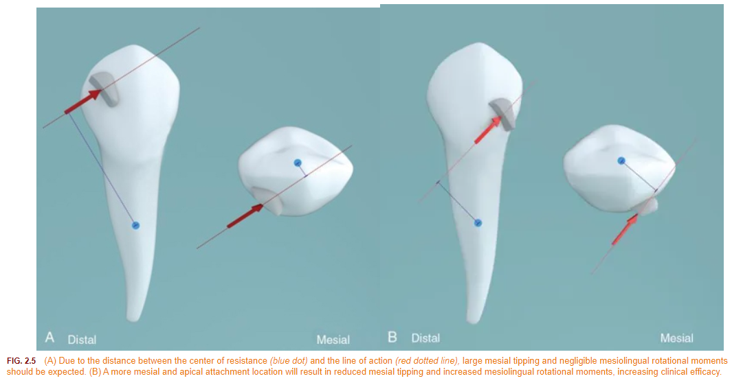 Rotating canines with aligners – Aligner ABC